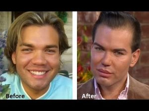 Human KEN will come to Colombia for his 25th plastic surgery - www ...